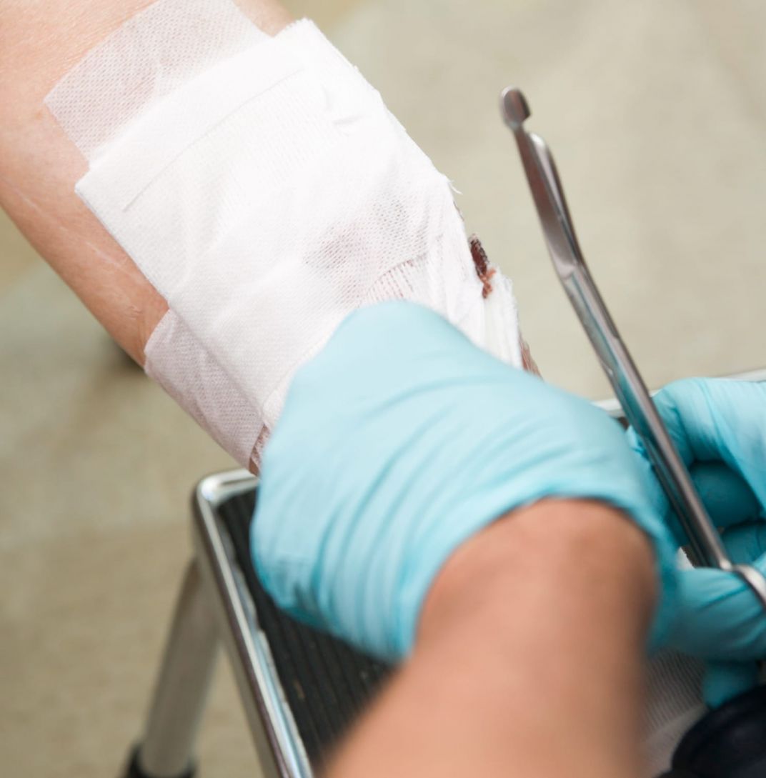 Ihre Experten für chronische Wunden | Wundzentrum Südwestfalen